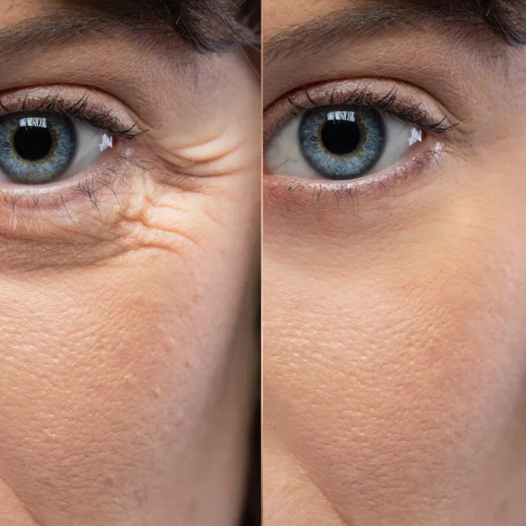 Alua™- Collageen Proteine