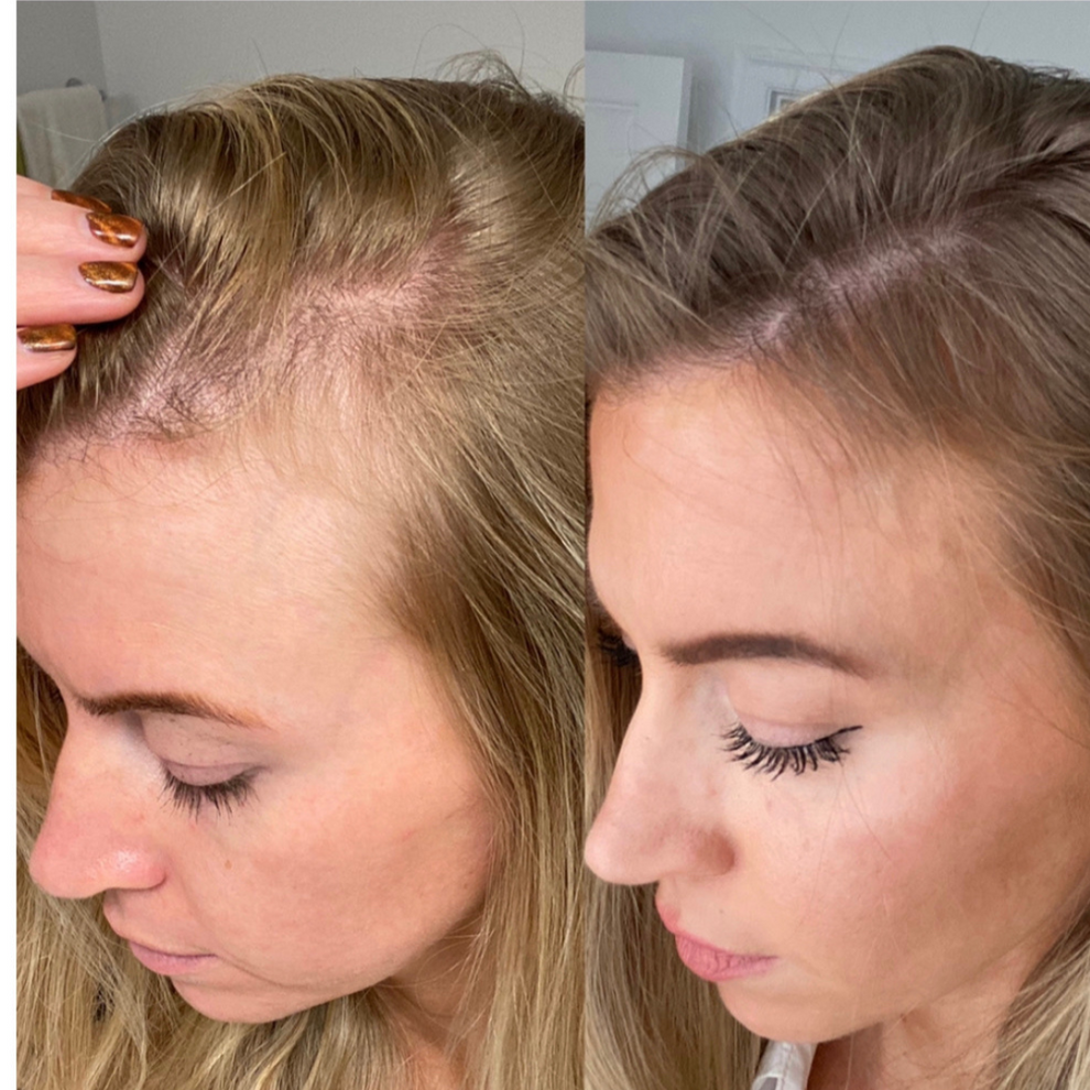 Alua™- Collageen Proteine